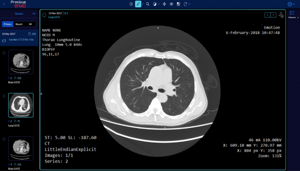 Revolutionising EGFR Testing with AI-Enhanced Imaging: Advancements by ...